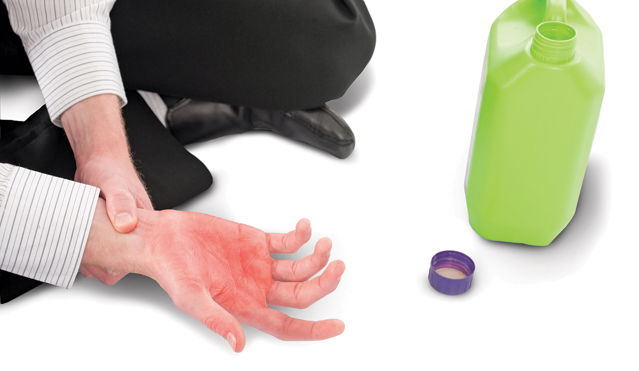 Chemical burns – E-Learning